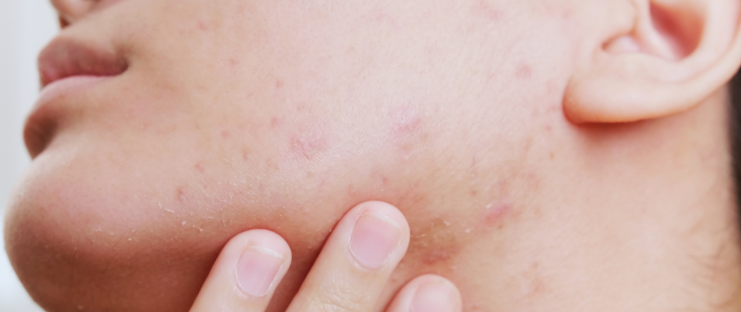 Building a Grooming Routine for Men’s Problematic Skin with Men Rock ...